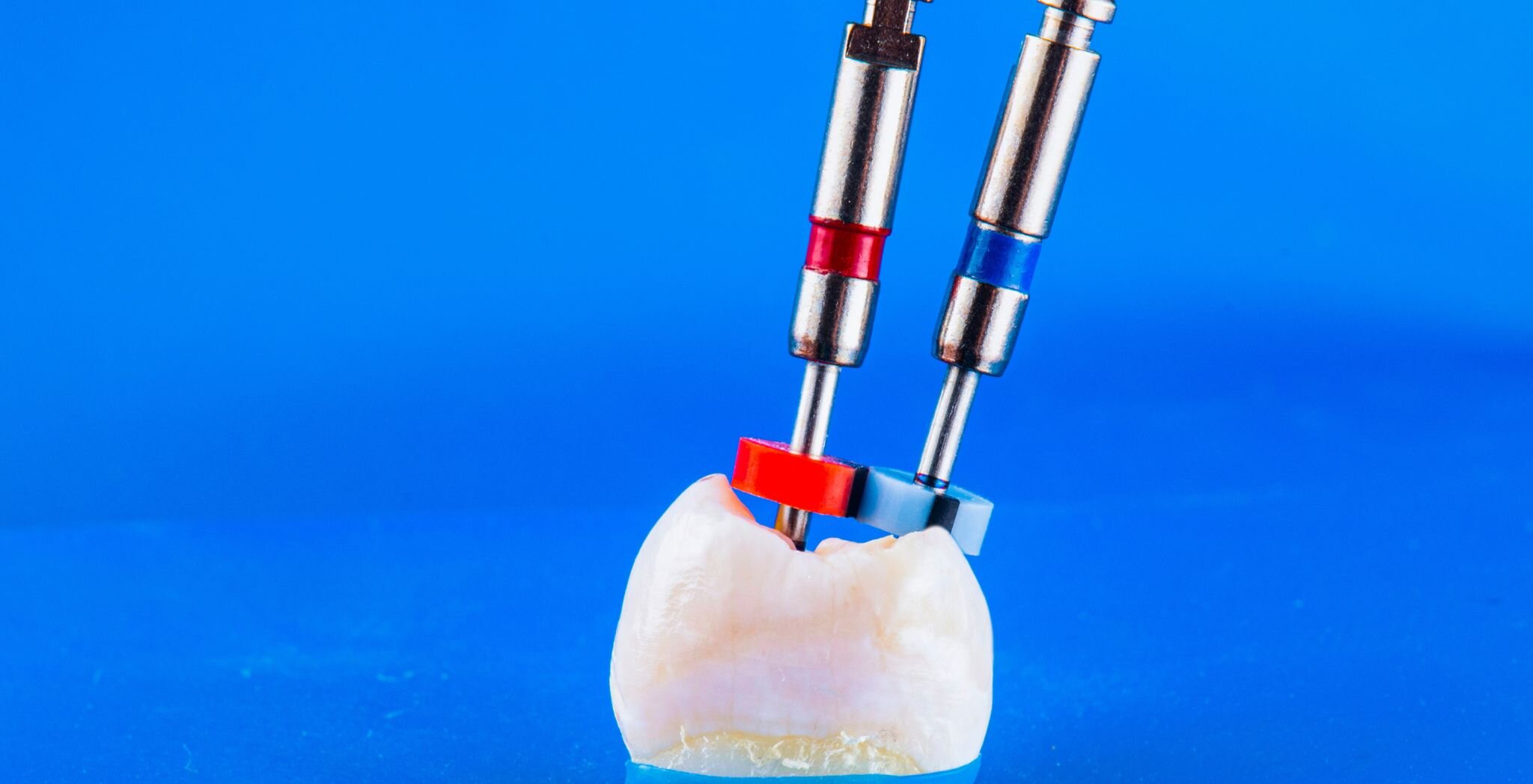 The Aftermath of Extraction: Recognizing Wisdom Teeth Removal Symptoms